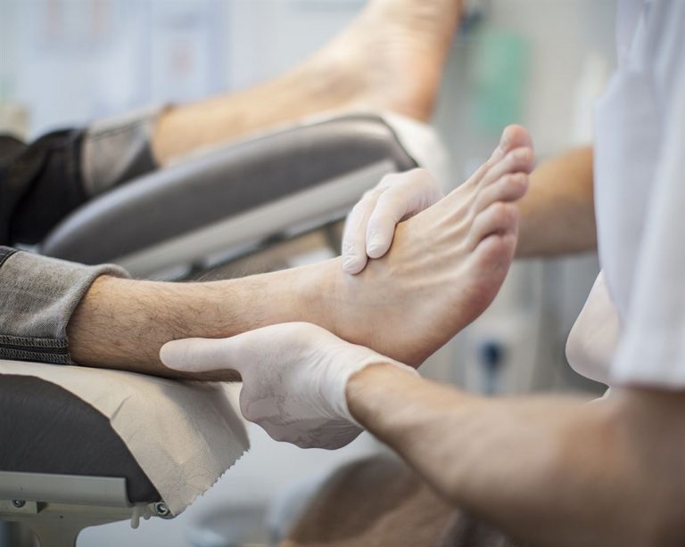 Fodsvamp - Tinea Pedis - Fodklinikken Aabenraa